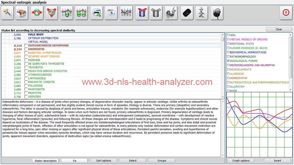 spectral antronic analysis - MAIKONG 3d nls health analyzer | 3d nls ...