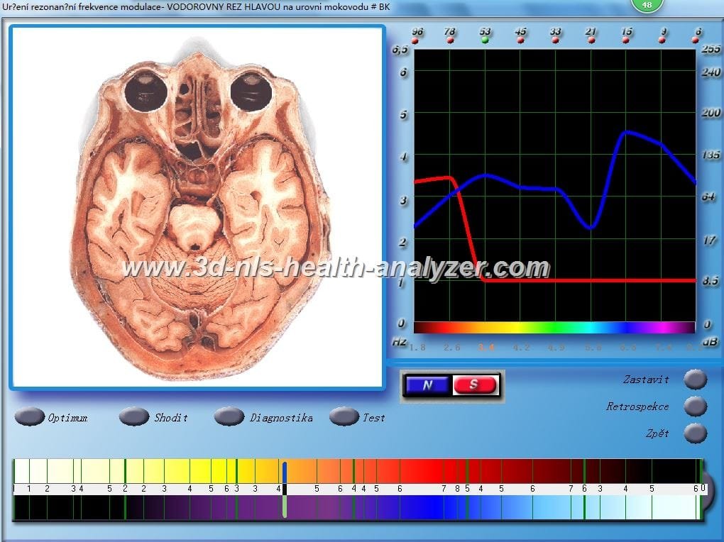 3d nls training manual - MAIKONG 3d nls health analyzer | 3d nls health ...
