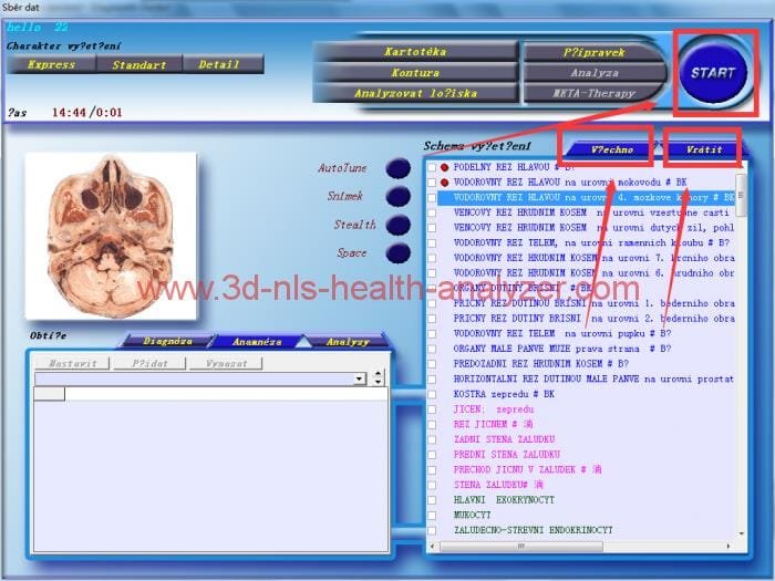 3d Nls Scanner - MAIKONG 3d Nls Health Analyzer | 3d Nls Health ...