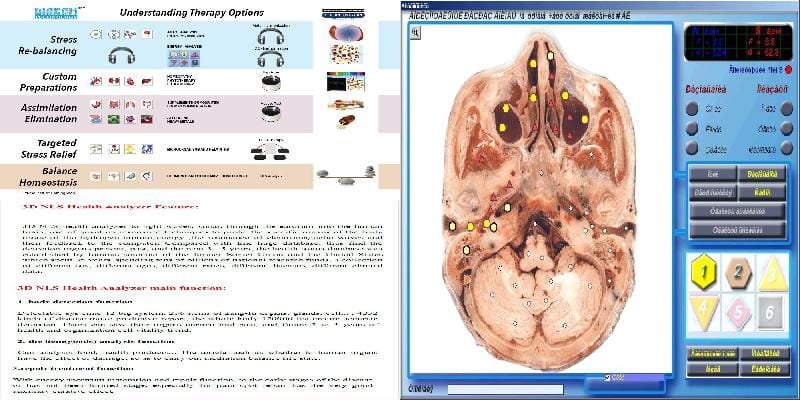3d nls system - MAIKONG 3d nls health analyzer | 3d nls health analyzer ...