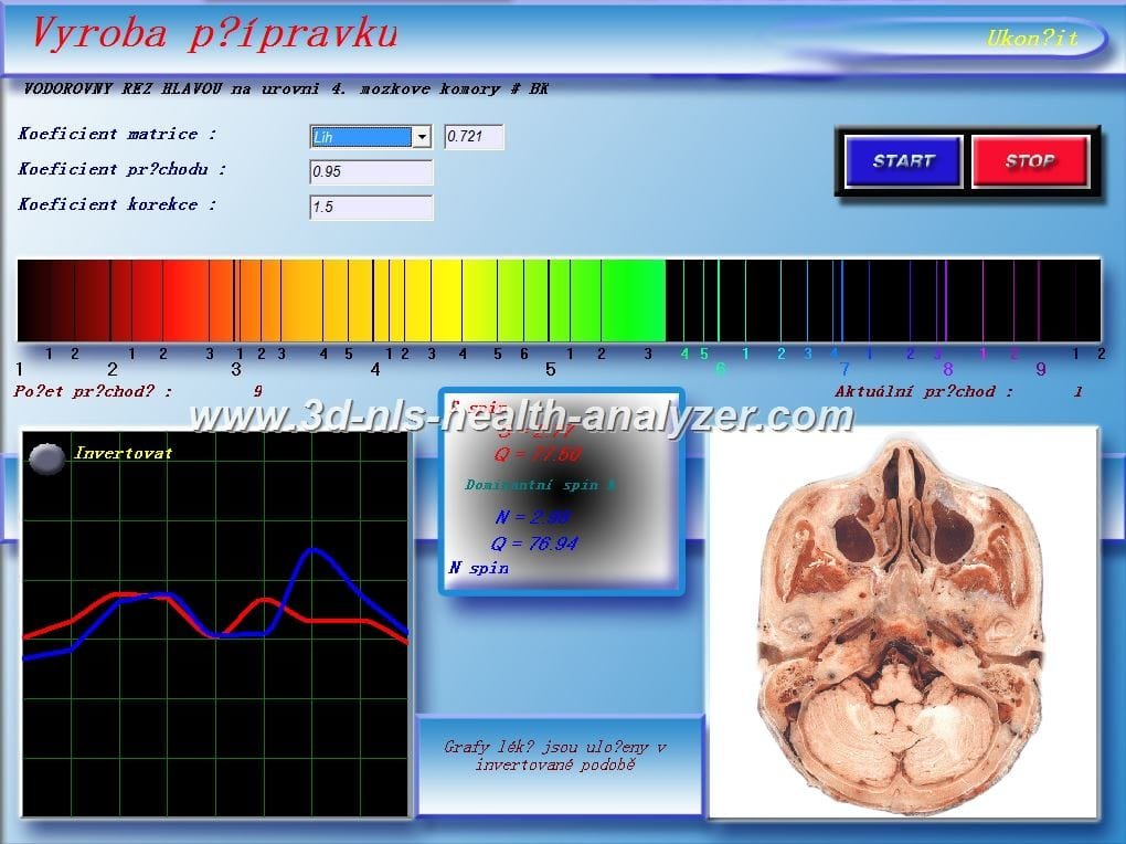 bioplasma nls what it how work why it and who need it? - MAIKONG 3d nls ...