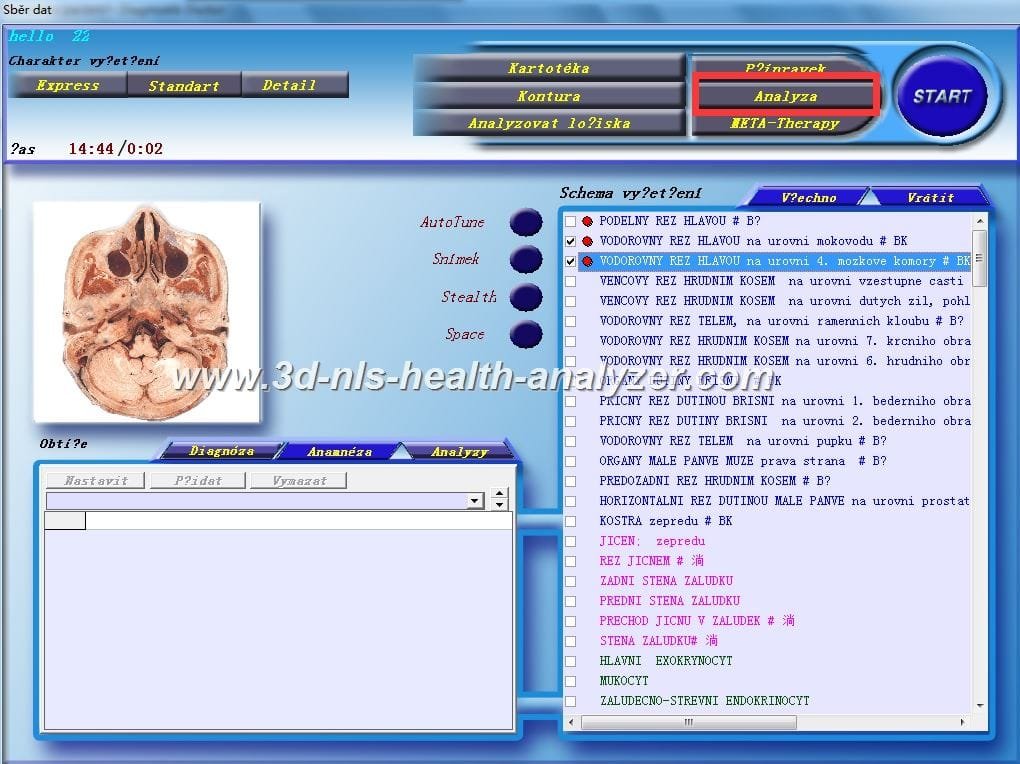 bioplasma nls what it how work why it and who need it? - MAIKONG 3d nls ...