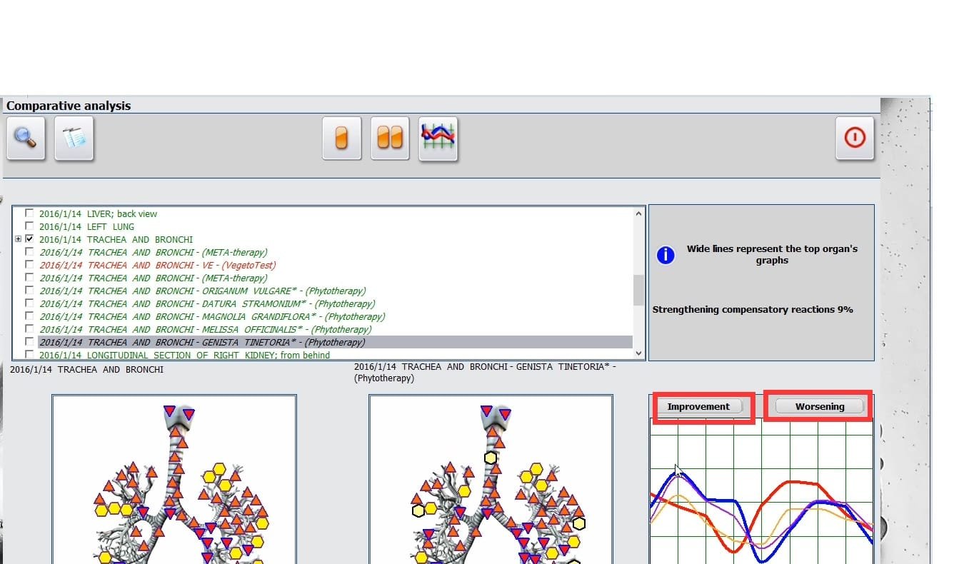 hunter nls what it how work why it and who need? - MAIKONG 3d nls ...