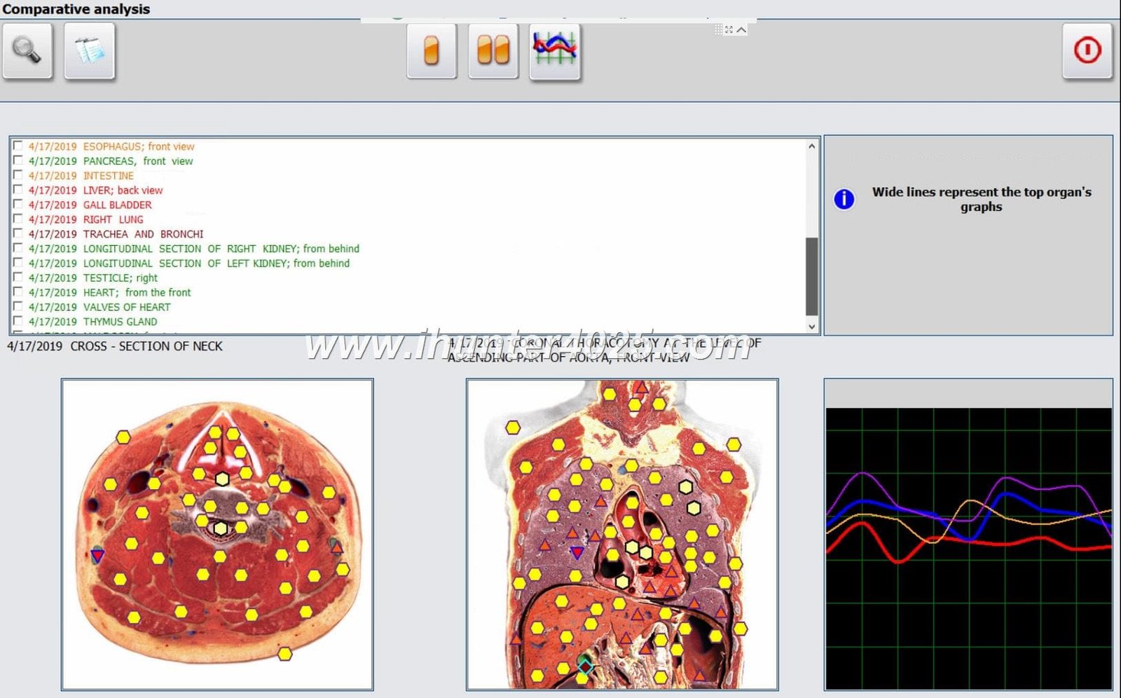 Nls Scan Why And Where Need It? - MAIKONG 3d Nls Health Analyzer | 3d ...