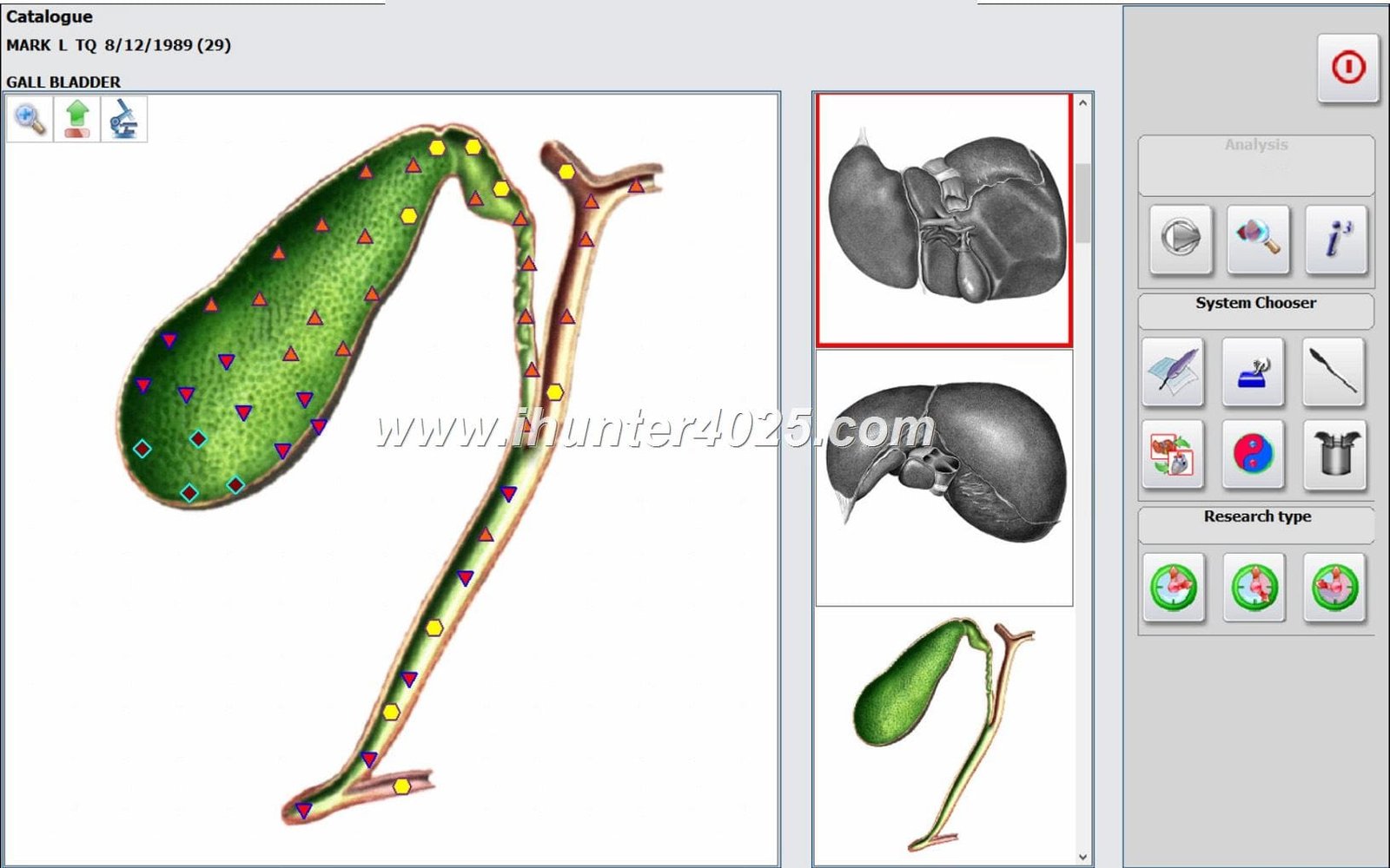 Nls Scan Why And Where Need It? - MAIKONG 3d Nls Health Analyzer | 3d ...