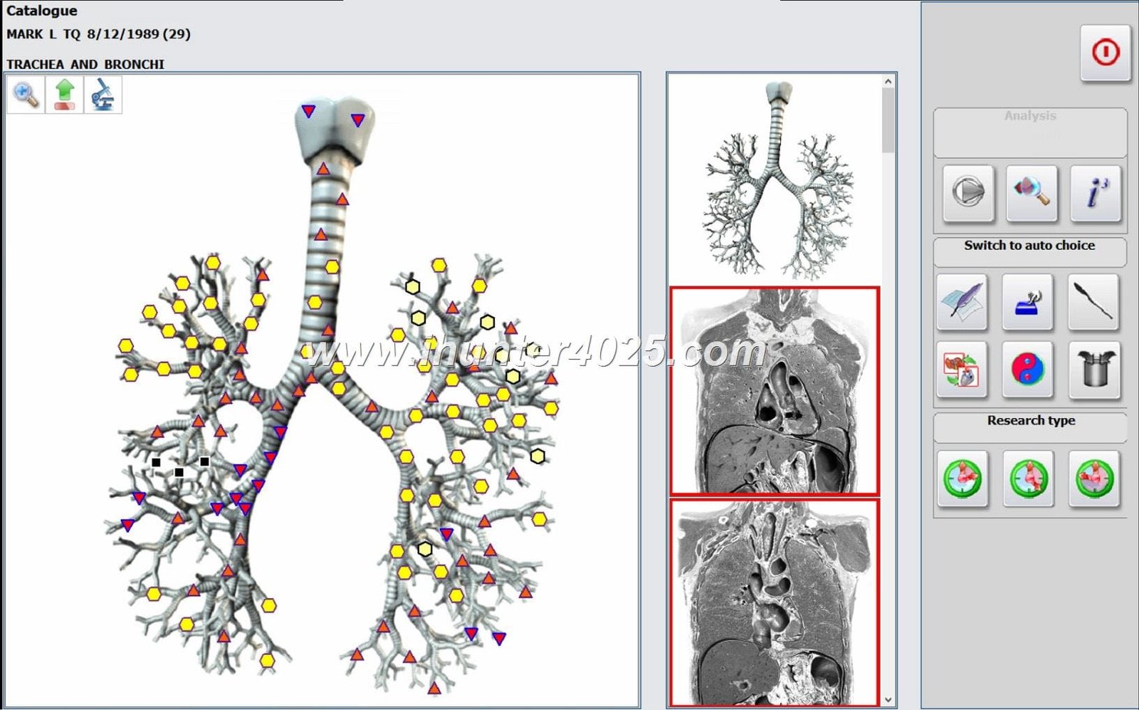 Nls Scan Why And Where Need It? - MAIKONG 3d Nls Health Analyzer | 3d ...