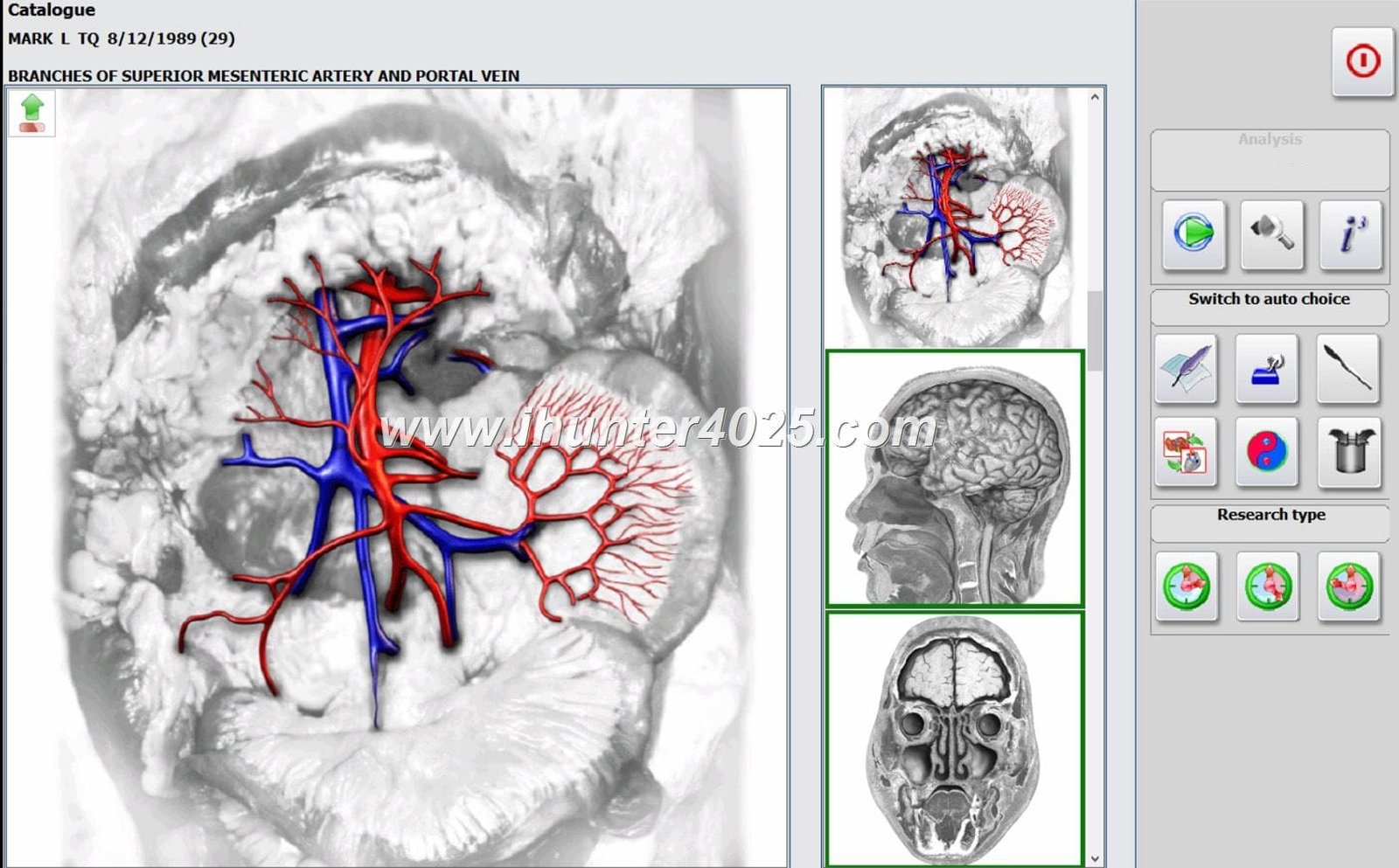 Nls Scan Why And Where Need It? - MAIKONG 3d Nls Health Analyzer | 3d ...