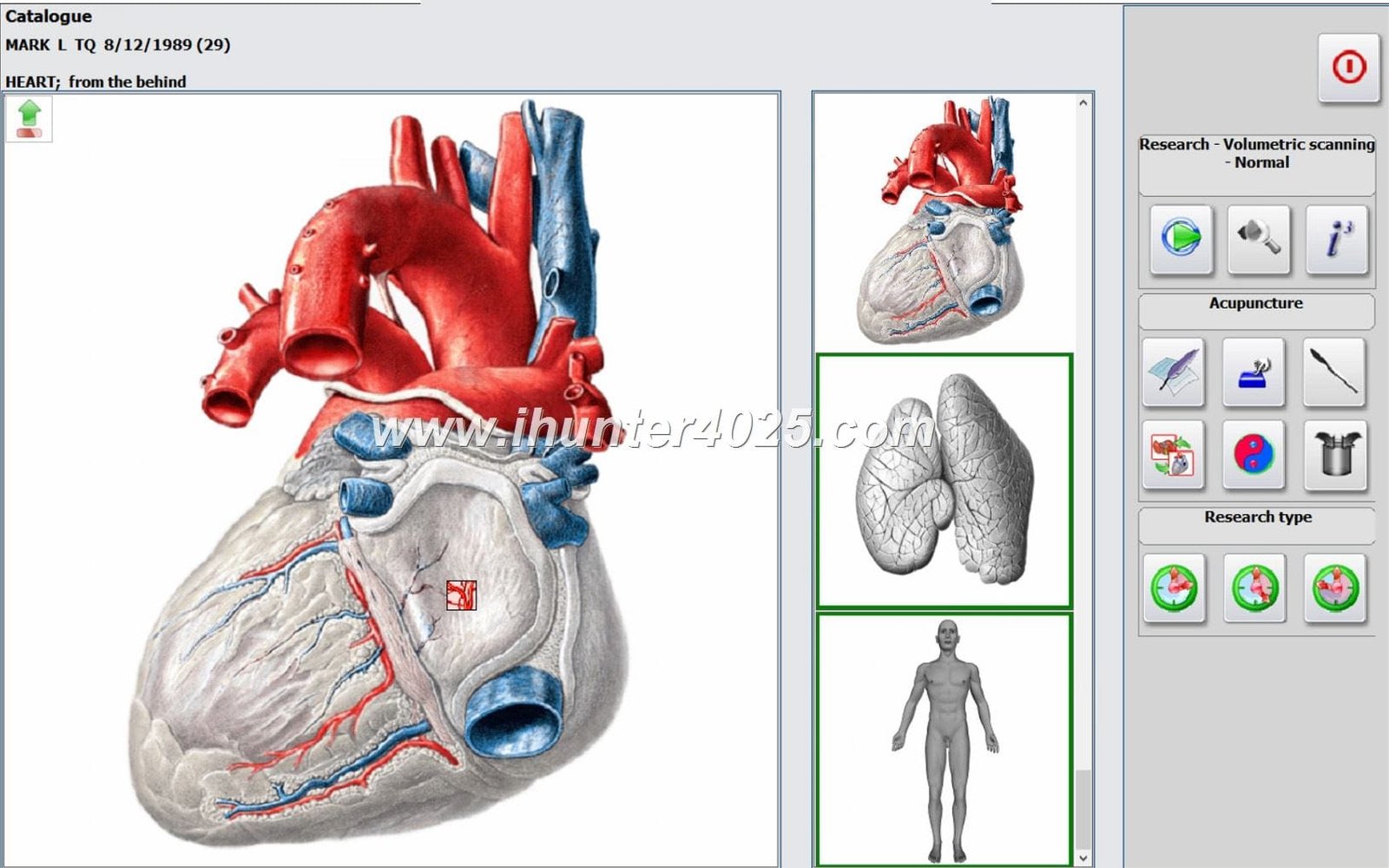 Nls Scan Why And Where Need It? - MAIKONG 3d Nls Health Analyzer | 3d ...