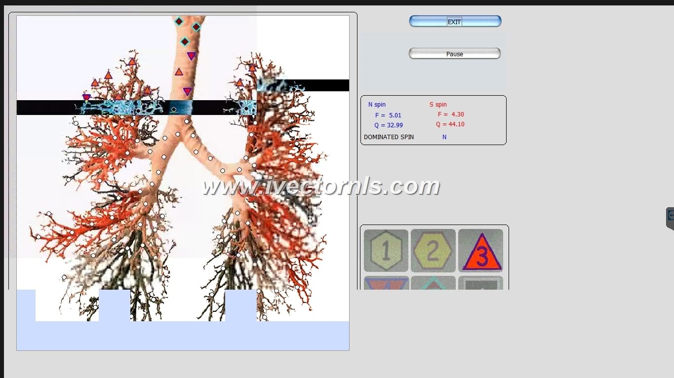 Metatron Diagnostic Machine Review - MAIKONG 3d Nls Health Analyzer ...