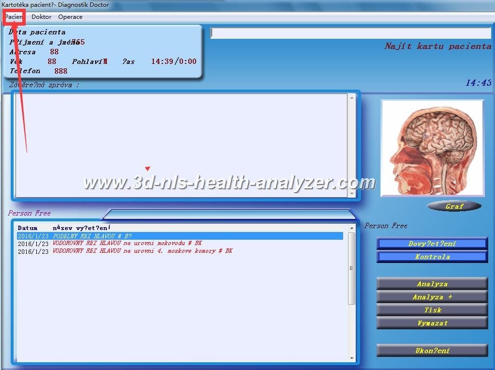 Diacom 3d Nls Software - MAIKONG 3d Nls Health Analyzer | 3d Nls Health Analyzer Price ...