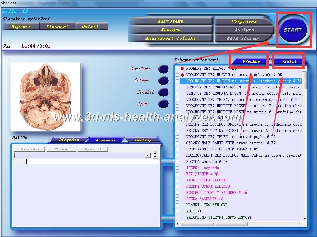 Diacom 3d Nls Software - MAIKONG 3d Nls Health Analyzer | 3d Nls Health Analyzer Price ...